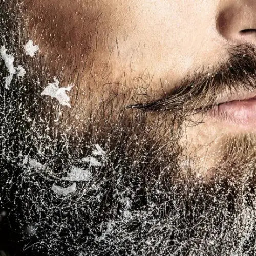 Beard White Flakes – 4Mation Skins| Science backed skincare for Men & Women
